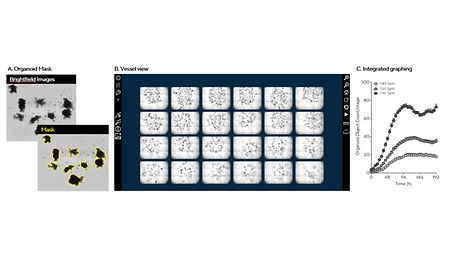 Incucyte Organoid Analysis Software | Sartorius