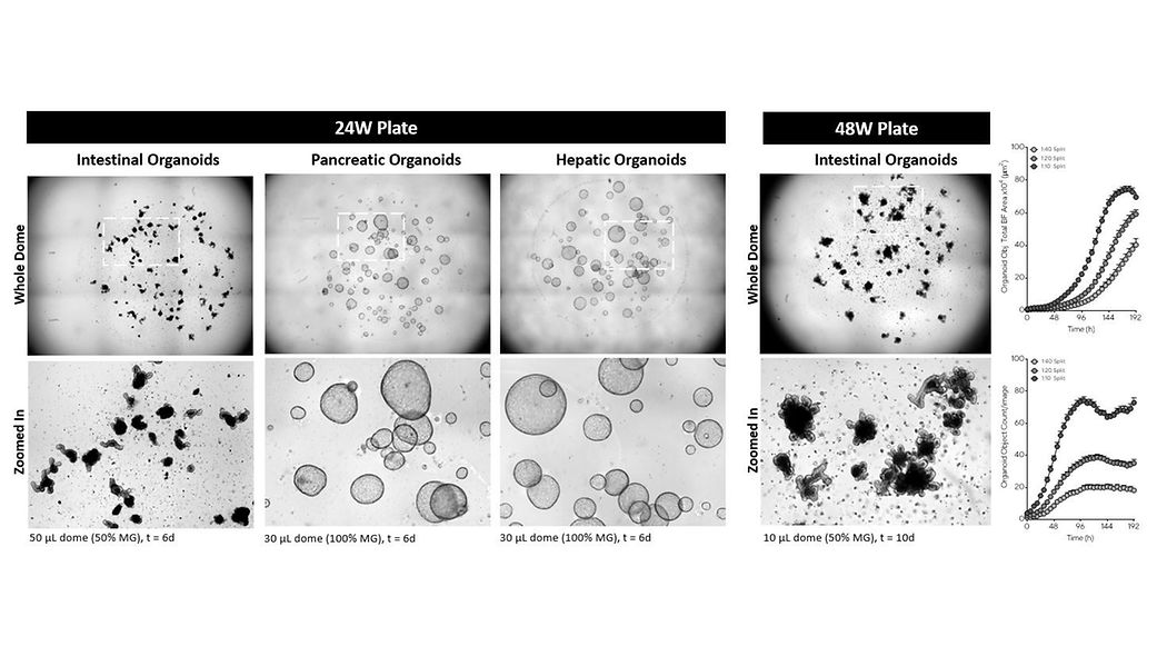 Incucyte Organoid Analysis Software | Sartorius