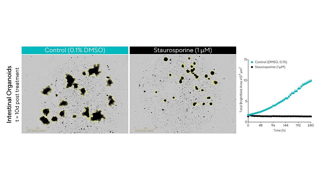 Incucyte Organoid Analysis Software | Sartorius