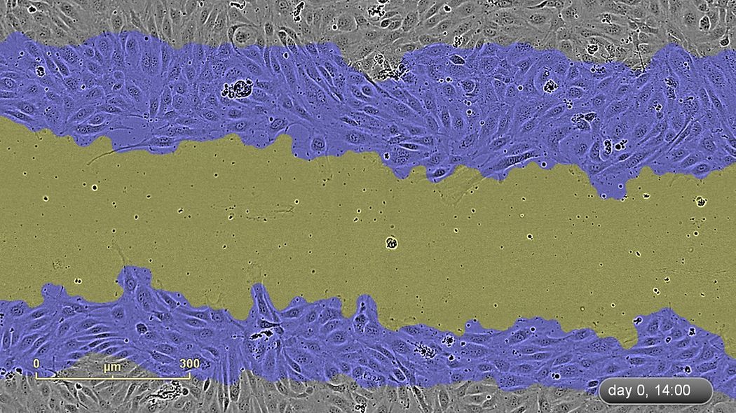 Incucyte Cell Migration Scratch Wound Analysis | Sartorius