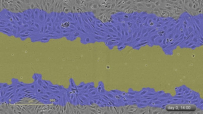 Incucyte Cell Migration Scratch Wound Analysis | Sartorius