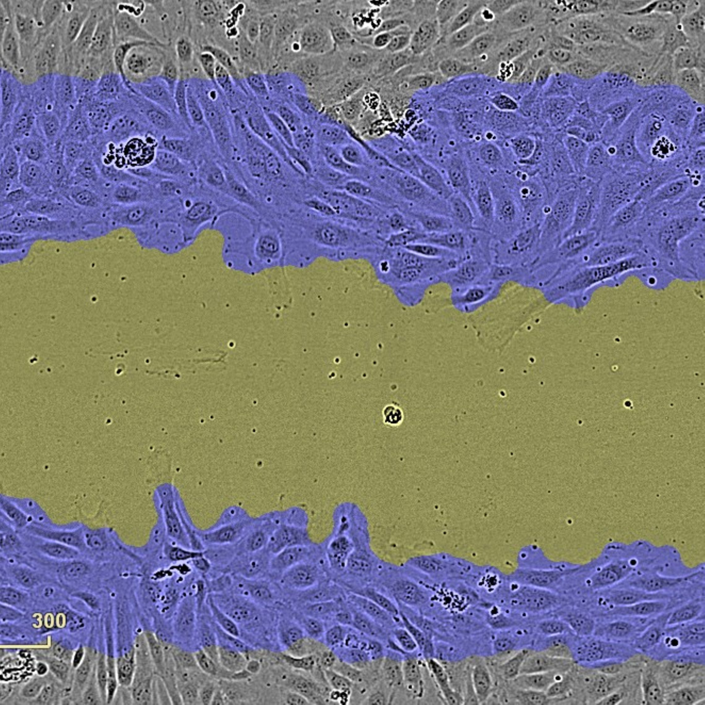 Incucyte Cell Migration Scratch Wound Analysis | Sartorius