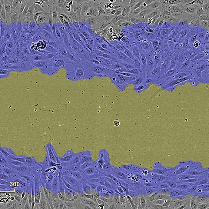 Incucyte Cell Migration Scratch Wound Analysis | Sartorius
