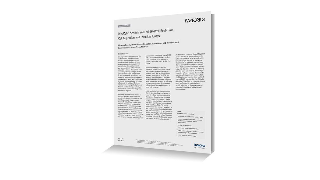 Incucyte Cell Migration Scratch Wound Analysis | Sartorius