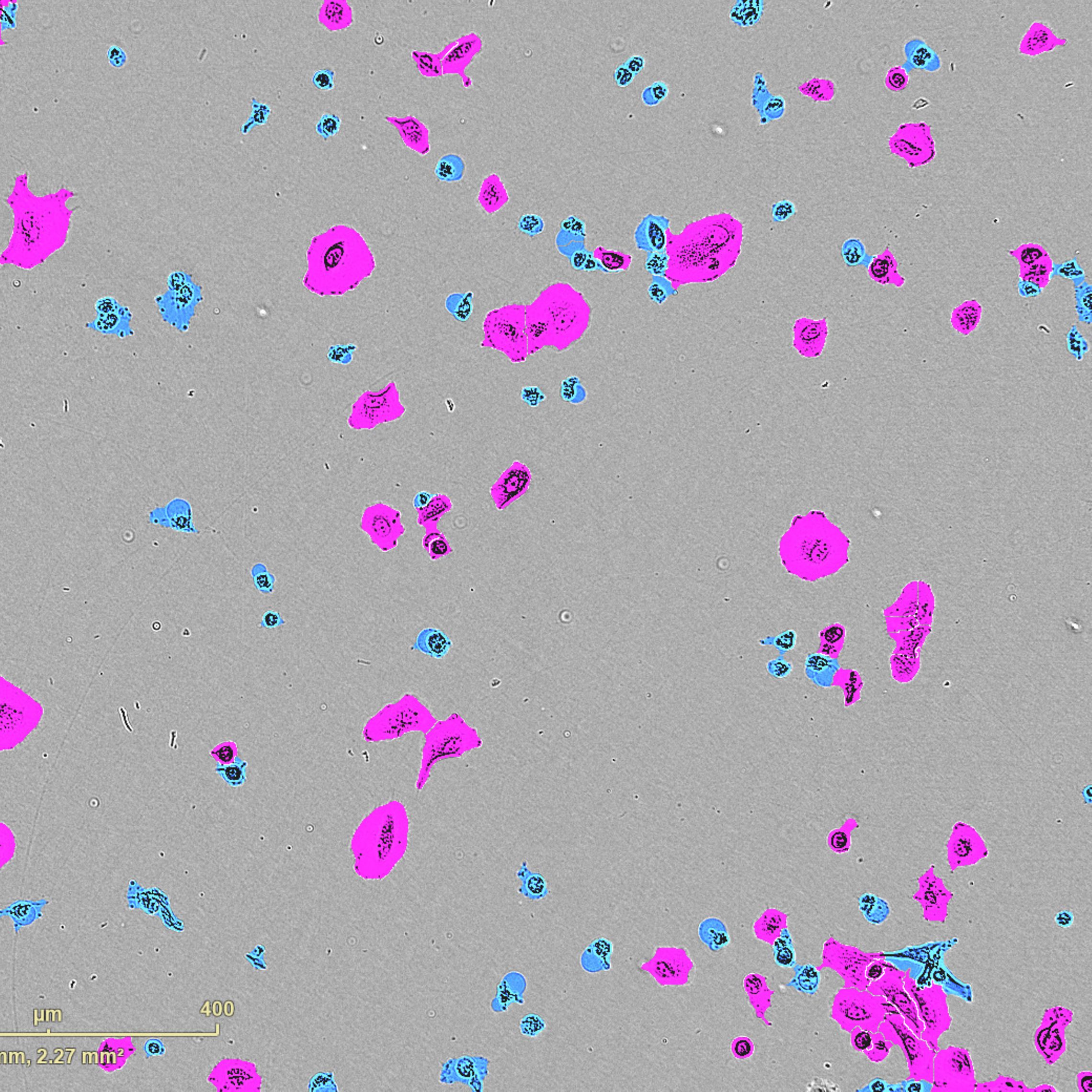 Morphological Analysis | Sartorius